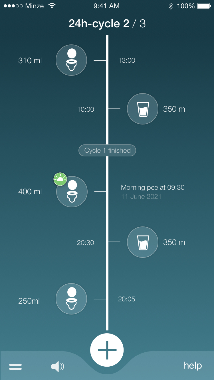Software Update: new features and release notes – Minze Help Center